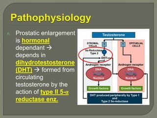 Benign prostatic hyperplasia | PPT
