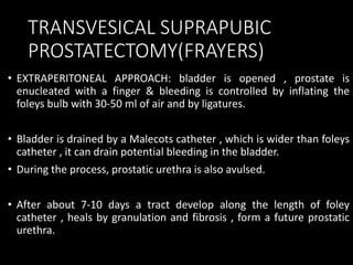 BENIGN PROSTATIC HYPERPLASIA.pptx