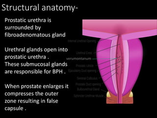 BENIGN PROSTATIC HYPERPLASIA.pptx