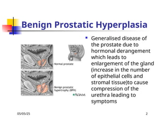 Benign Prostatic Hyperplasia slides..ppt