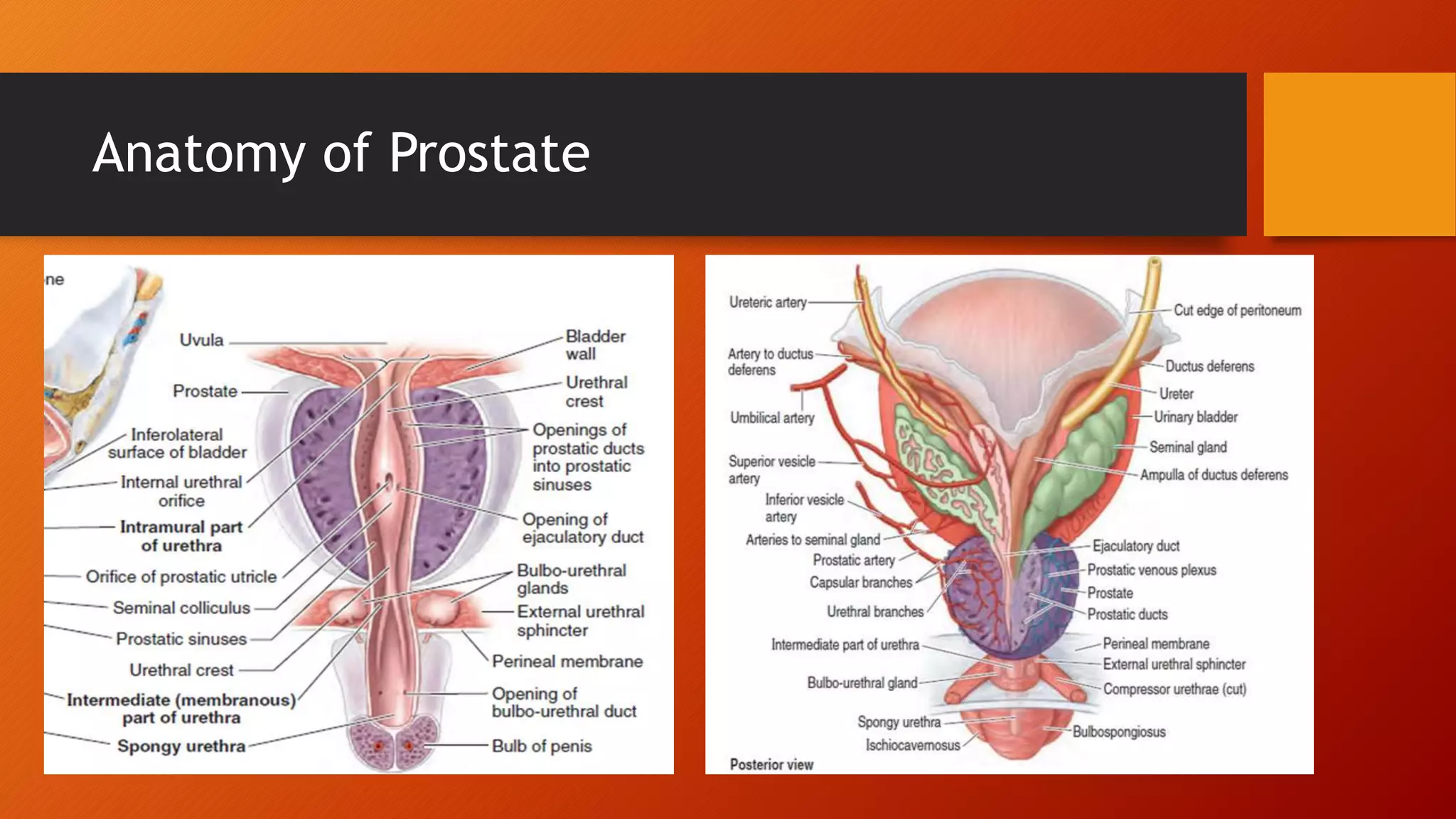 Benign prostatic hyperplasia (bph) | PPTX