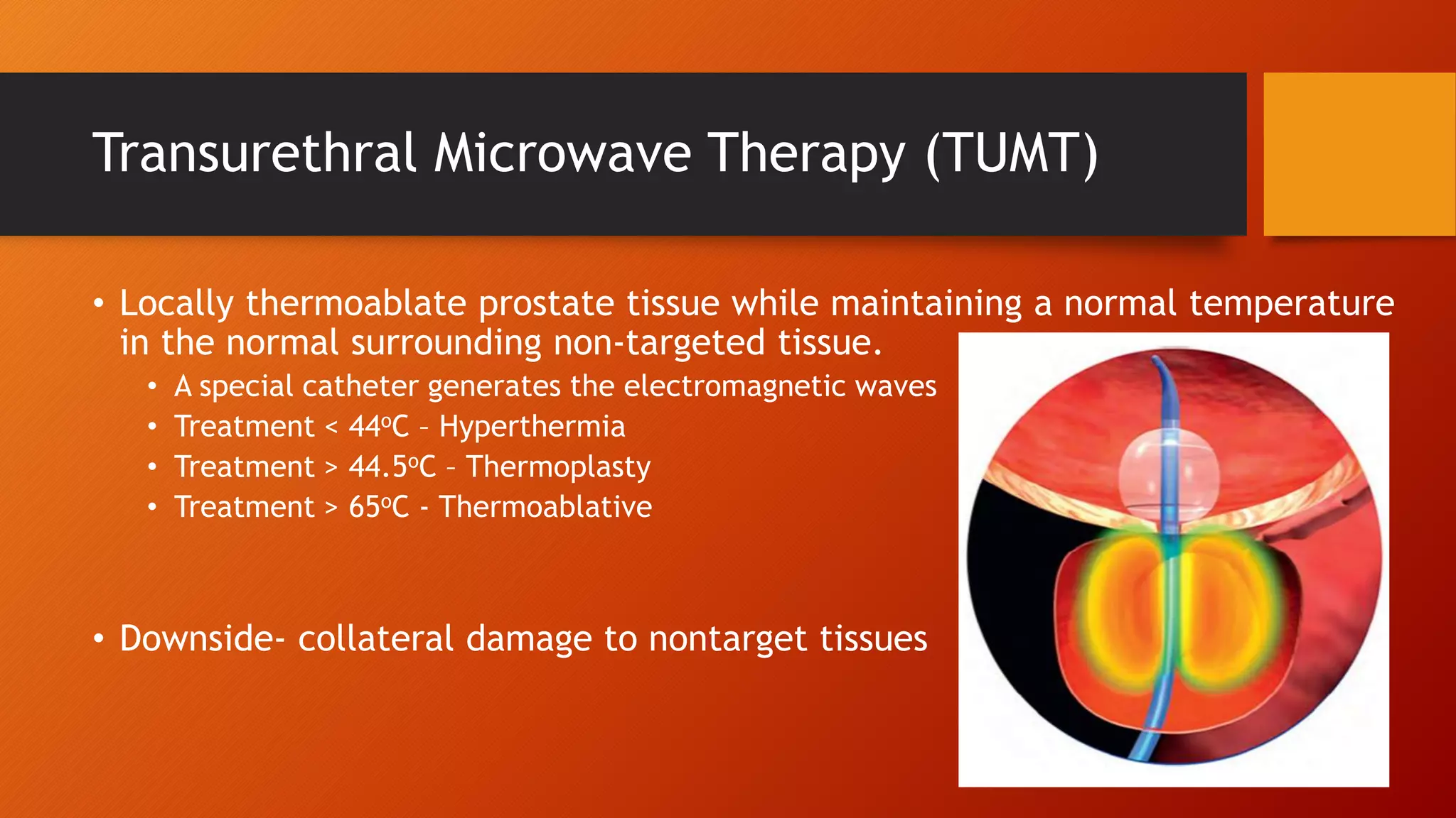 Benign prostatic hyperplasia (bph) | PPTX