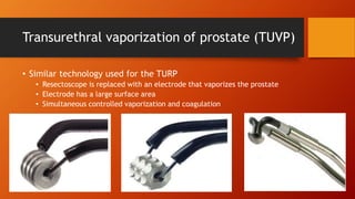 Benign prostatic hyperplasia (bph) | PPTX
