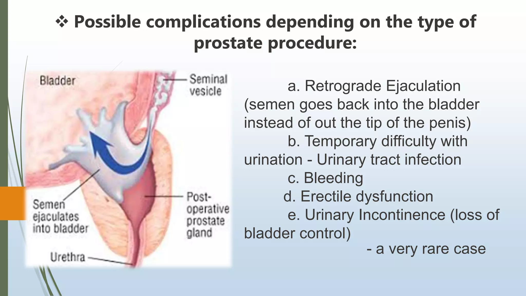 Benign Prostatic Hyperplasia (BPH) - Rivin | PPTX