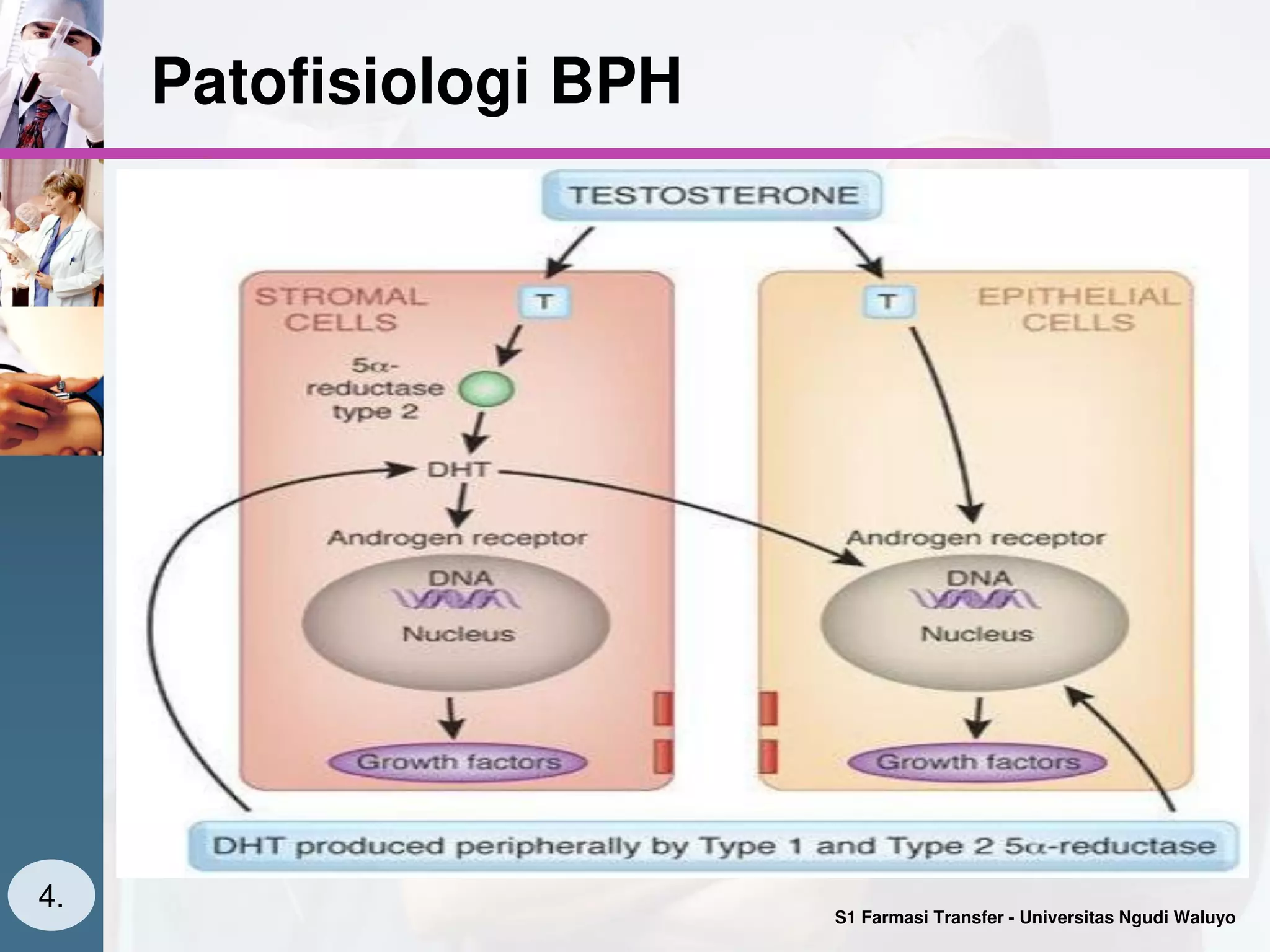 Benign_Prostatic_Hyperplasia_BPH_PPT_Pem.pdf