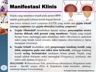 Benign_Prostatic_Hyperplasia_BPH_PPT_Pem.pdf