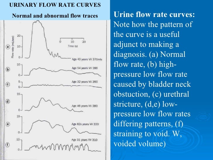 Benign Prostatic Hyperplasia & Incontinence New