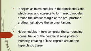BENIGN PROSTATIC HYPERPLASIA PPT.pptx
