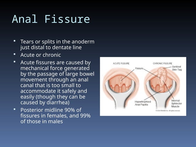 Benign rectal anal and Perinial Problems.ppt