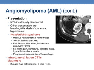 Curriculum Conference - Benign Renal Tumors | PPT