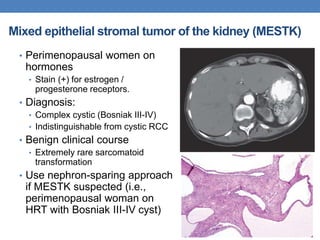 Curriculum Conference - Benign Renal Tumors | PPT