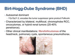 Curriculum Conference - Benign Renal Tumors | PPT