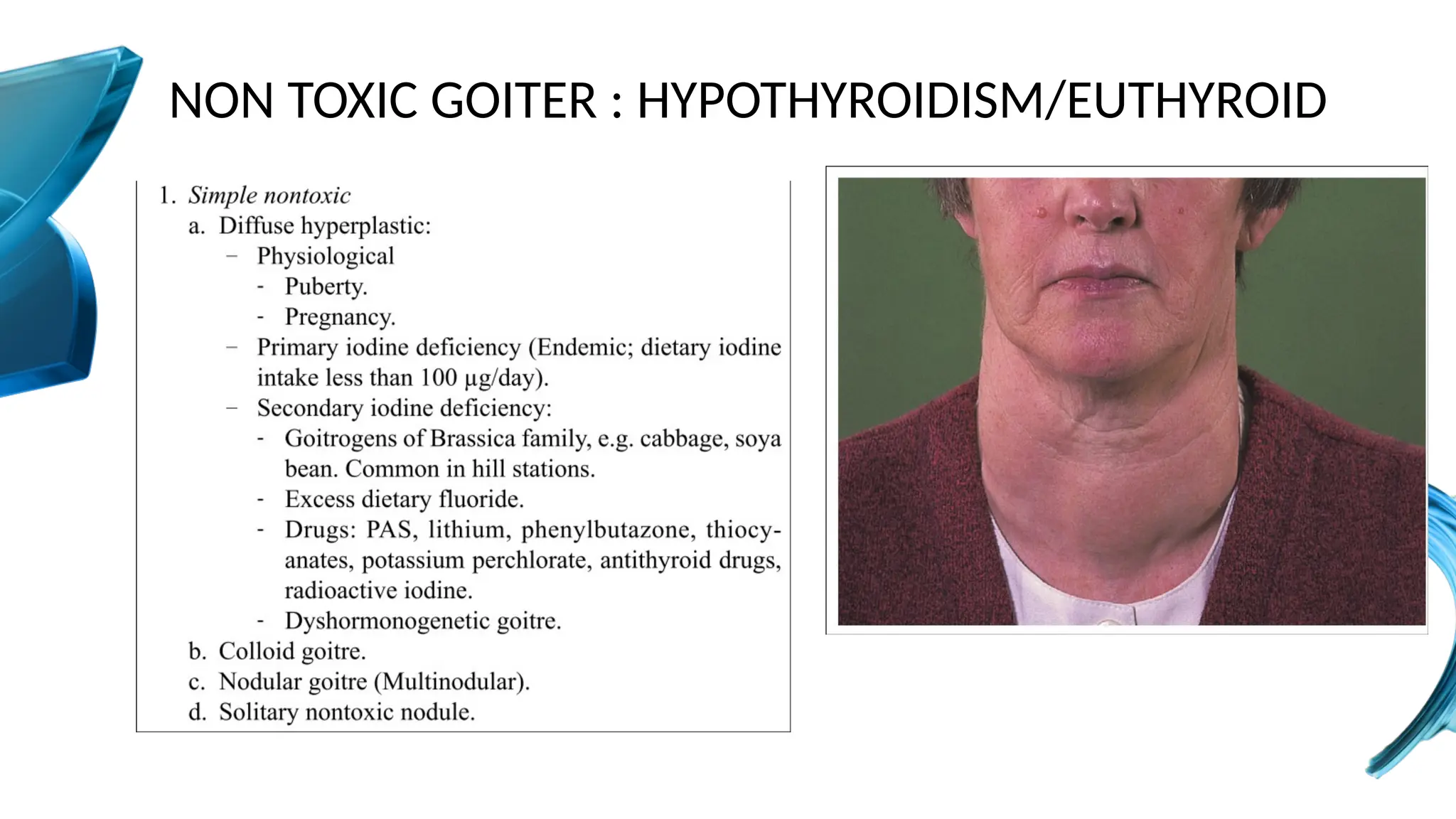 Benign Thyroid Diseases: Hypothyroidism and Hyperthyroidism; Graves ...