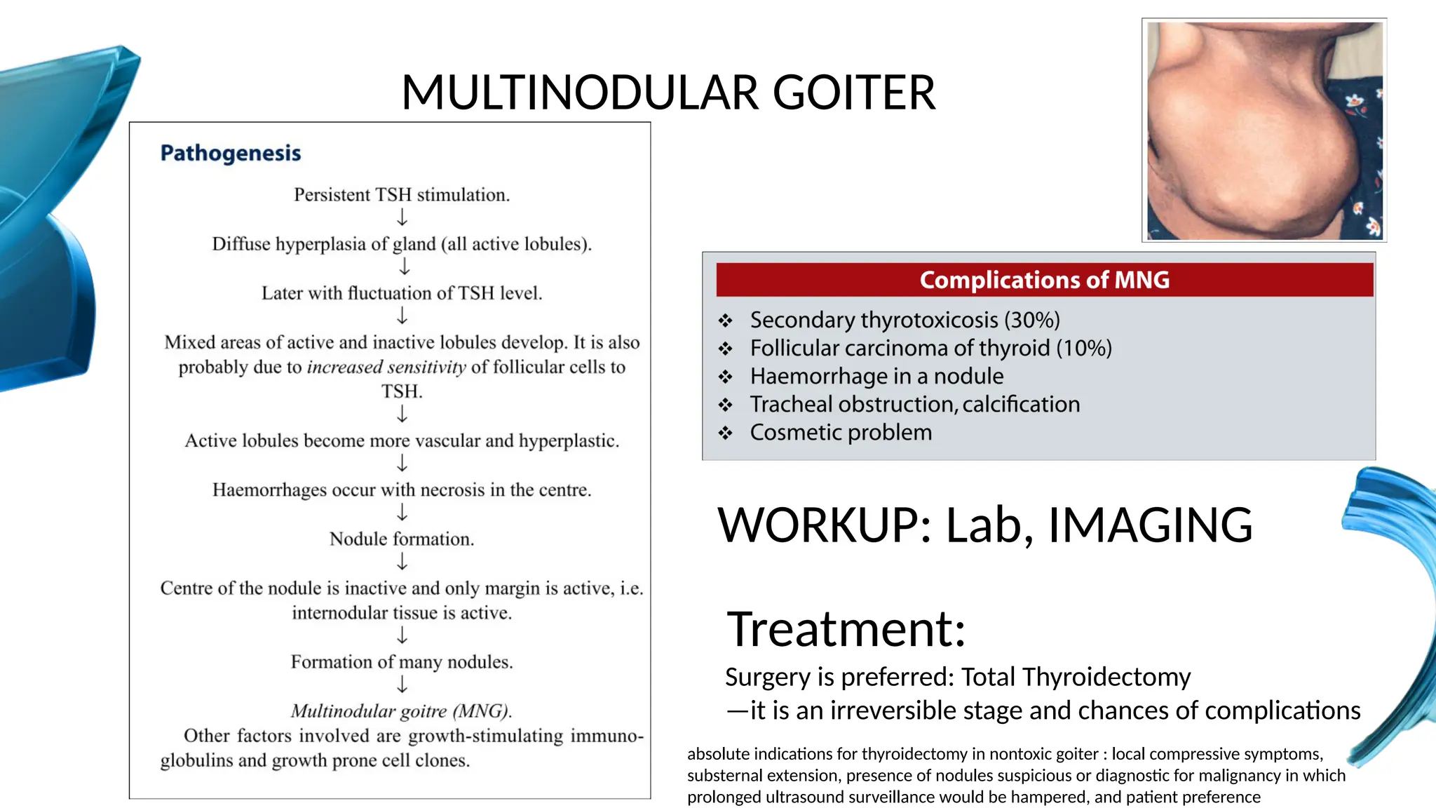 Benign Thyroid Diseases: Hypothyroidism and Hyperthyroidism; Graves ...