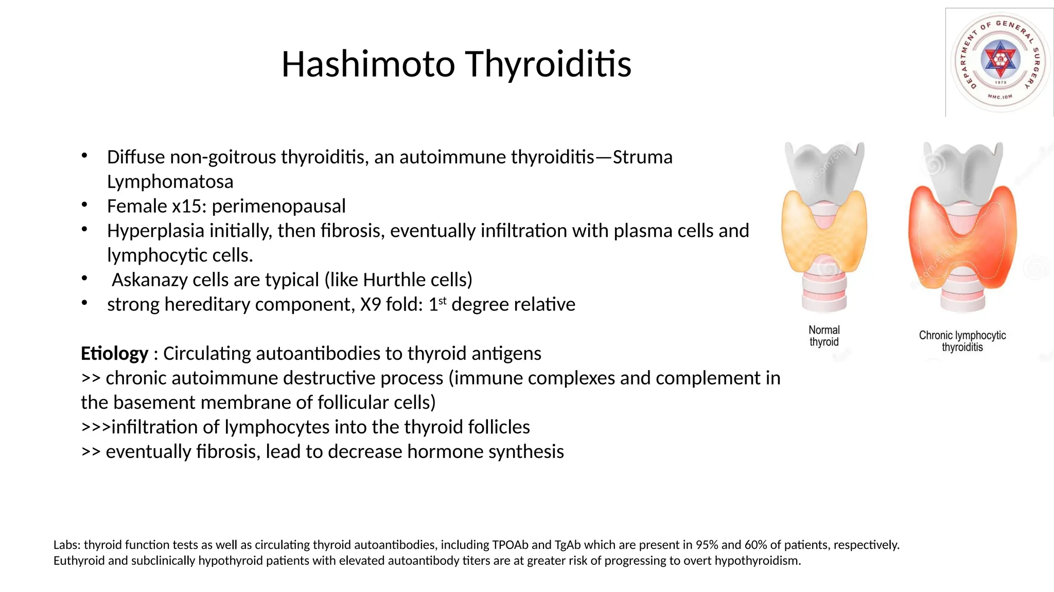 Benign Thyroid Diseases: Hypothyroidism and Hyperthyroidism; Graves ...