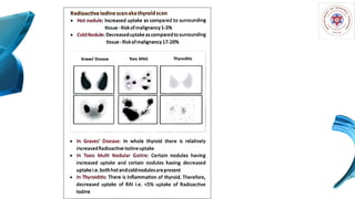 Benign Thyroid Diseases: Hypothyroidism and Hyperthyroidism; Graves ...