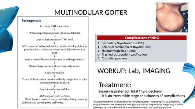 Benign Thyroid Diseases: Hypothyroidism and Hyperthyroidism; Graves ...