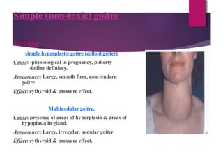 Benign thyroid disorders_(lecture) | PPT