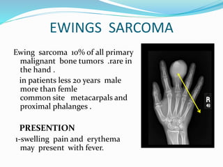 Benigntumorsinorthopaedics 141225104145-conversion-gate02 D. HAIFA ...