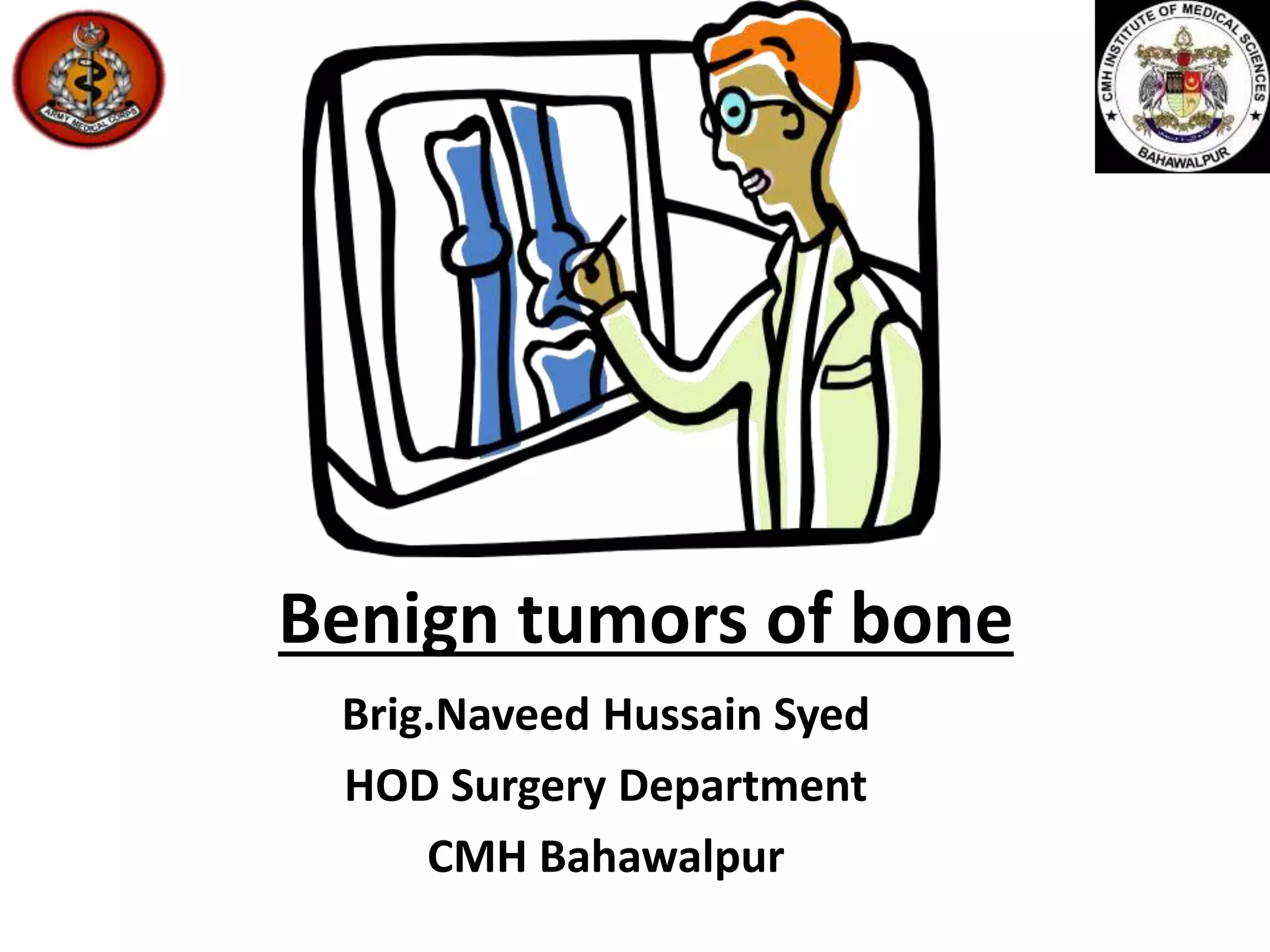 benign tumors of bone 1.pptx