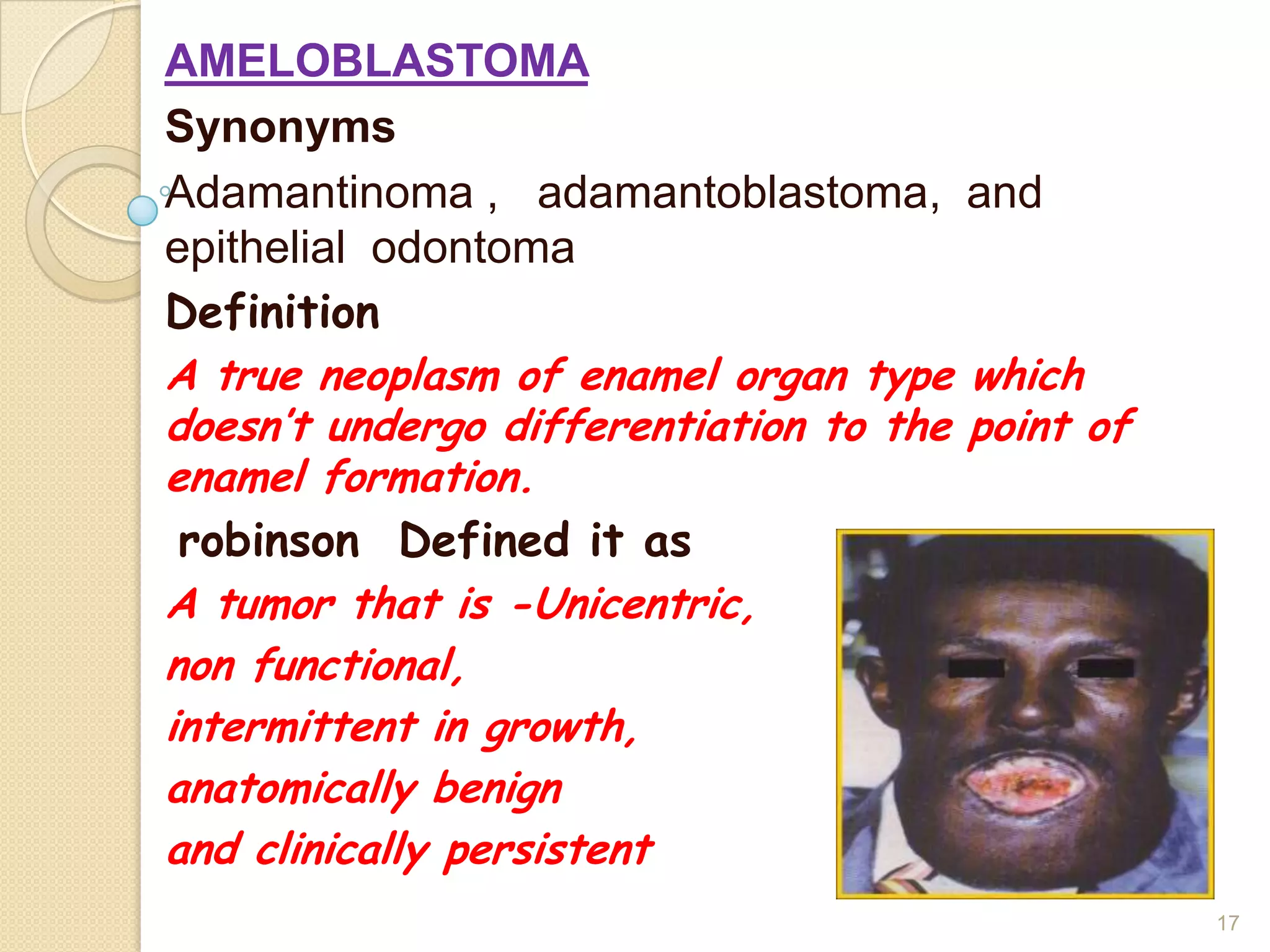 Benign tumors of jaw | PPT