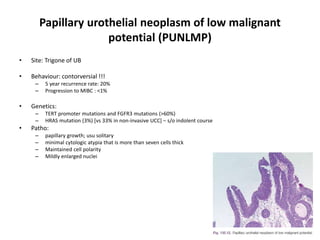 Benign tumors and Mimickers of UB tumors.pptx