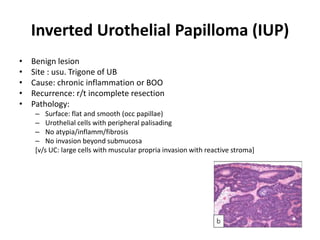 Benign tumors and Mimickers of UB tumors.pptx | Cancer | Diseases and ...