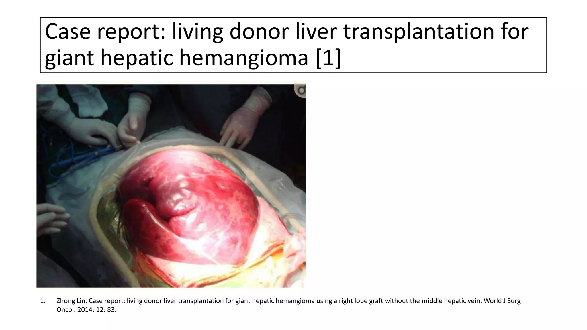 Benign tumour of liver hemangioma | PPTX
