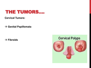 Benign tumours,cysts | PPTX