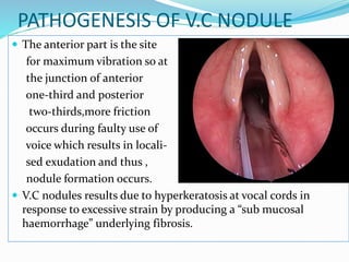 Benign tumours of larynx | PPTX