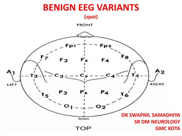 Benign variants in eeg | PPTX | Sleep Disorders | Diseases and Conditions