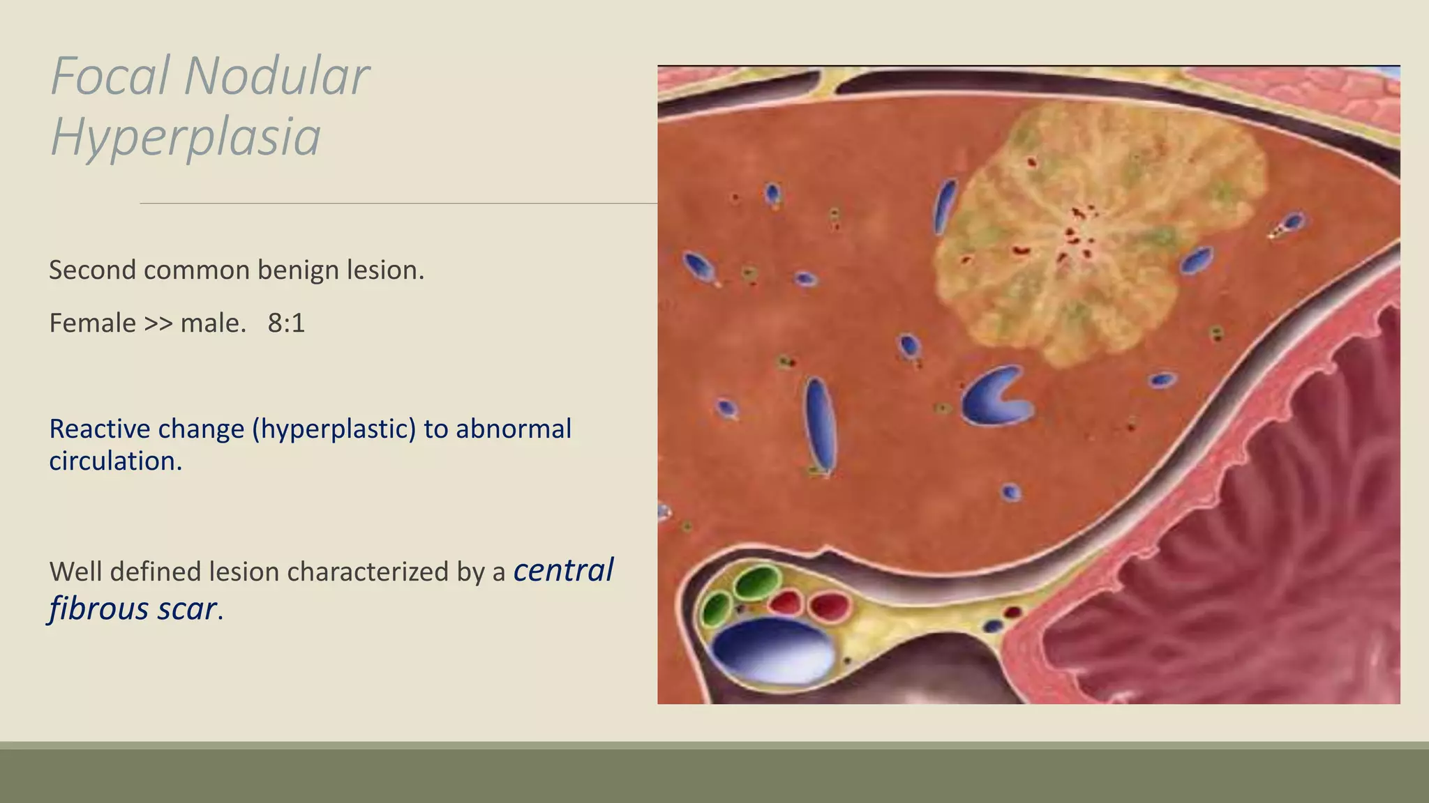 Benign hepatic masses | PPTX