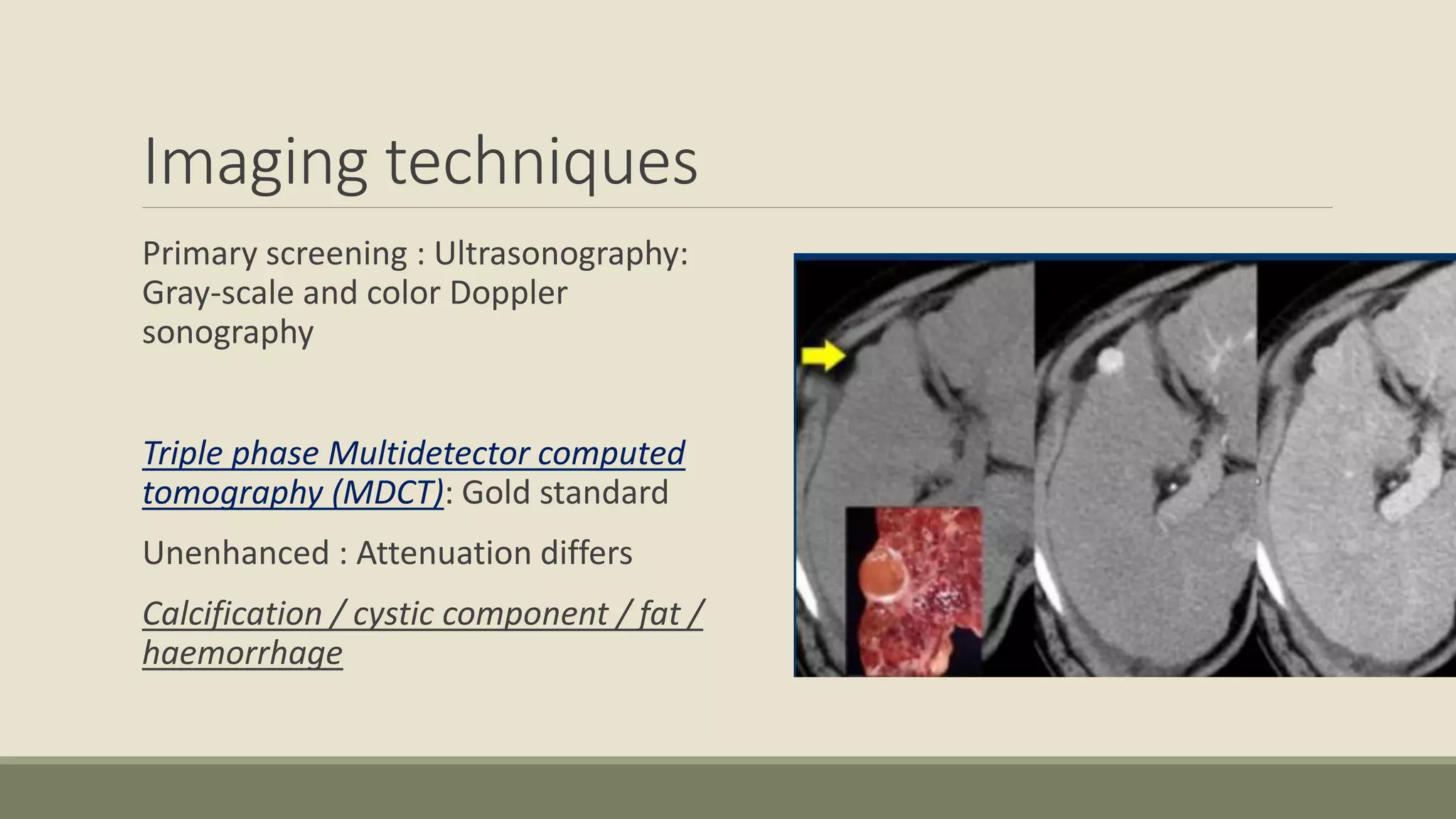 Benign hepatic masses | PPTX