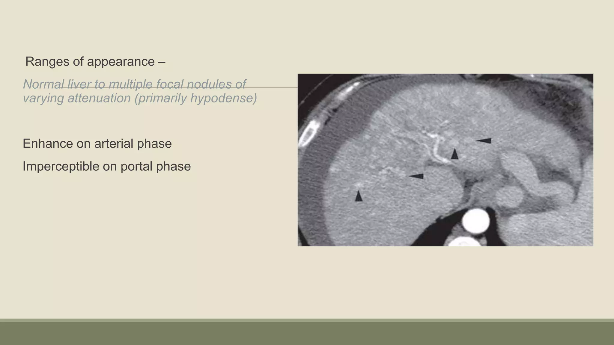 Benign hepatic masses | PPTX