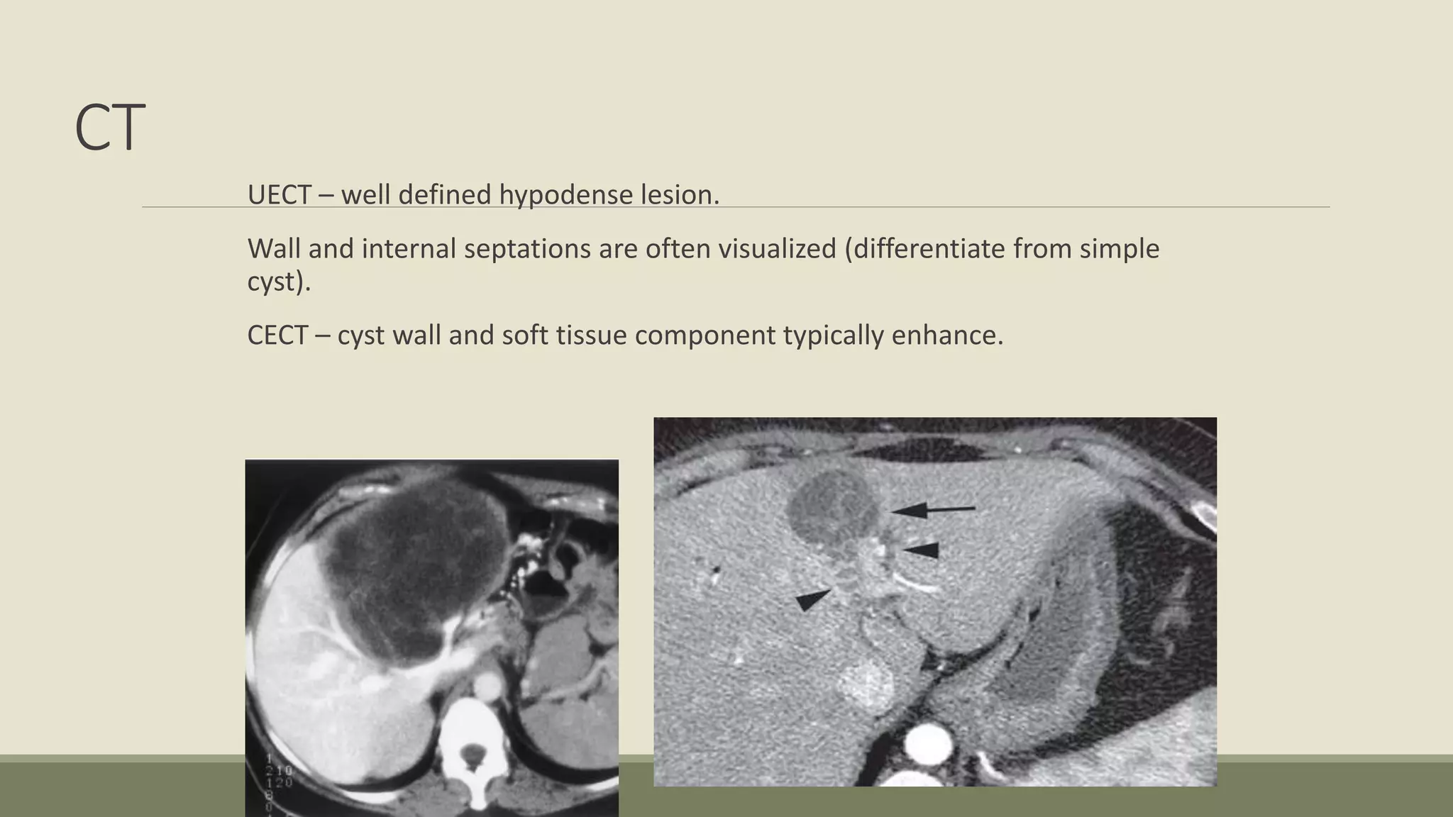 Benign hepatic masses | PPTX