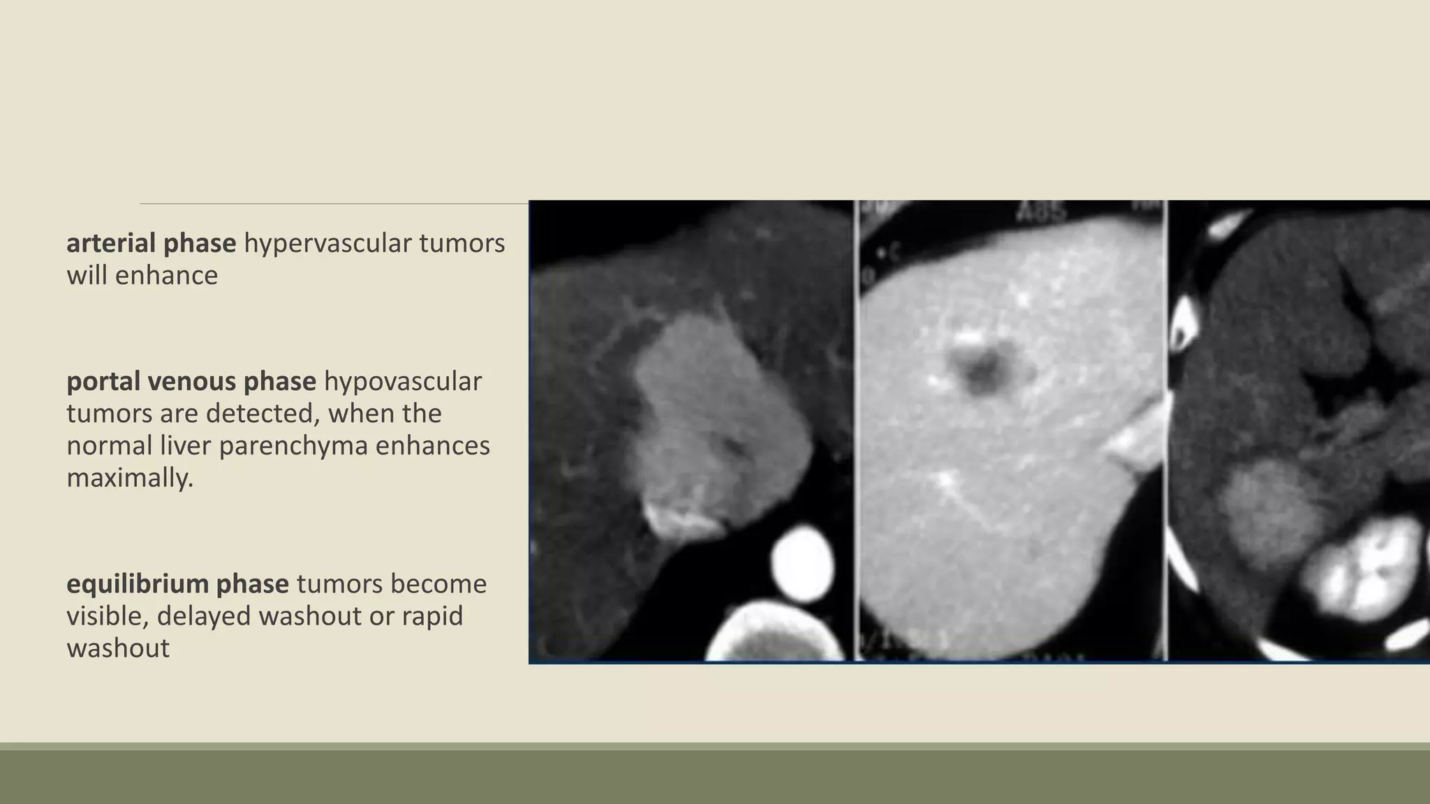 Benign hepatic masses | PPTX