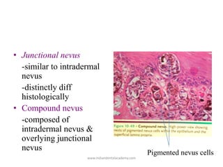 Beningn epithelial tumors ii/certified fixed orthodontic courses by ...