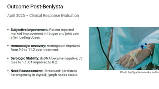 Benlysta in Systemic Lupus Erythematosus: Case and Therapeutic Overview ...