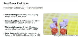 Benlysta in Systemic Lupus Erythematosus: Case and Therapeutic Overview ...
