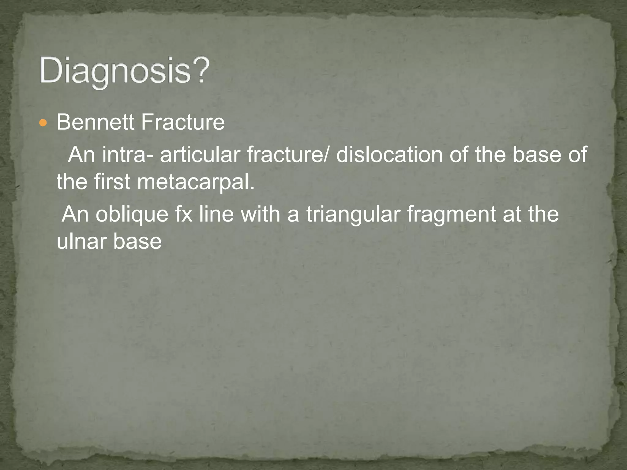 Bennet's Fracture Power Point | PPTX