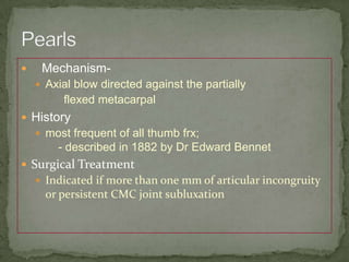 Bennet's Fracture Power Point | PPTX