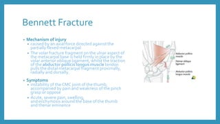 Bennett extern conference | PPTX | Death, Injury, or Military Conflict ...