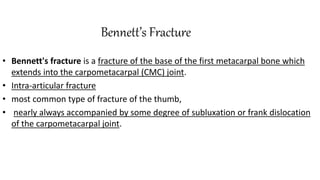 Bennett Fracture
