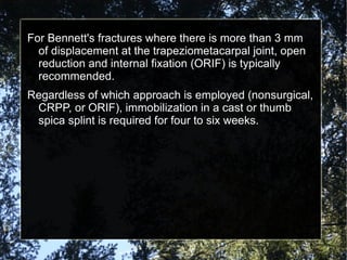 Bennetts Fracture | ODP