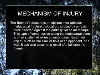 Bennetts Fracture | ODP