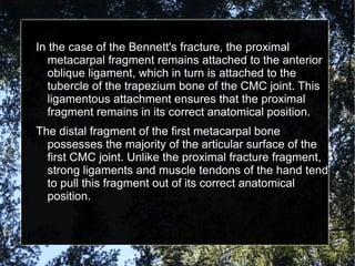 Bennetts Fracture | ODP