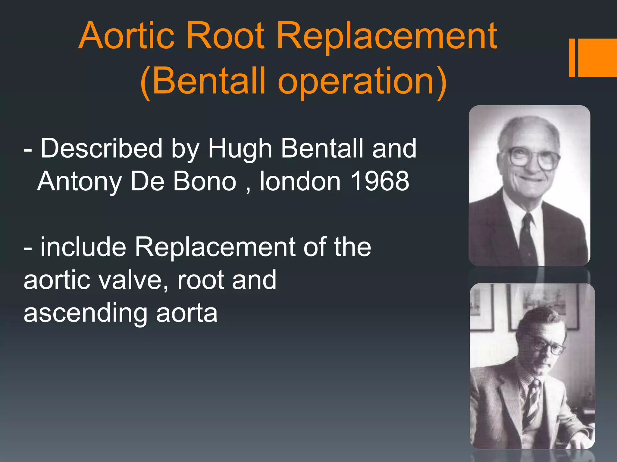 Aortic root surgery. Bentall operation | PPTX