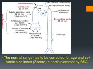 Aortic root surgery. Bentall operation | PPTX
