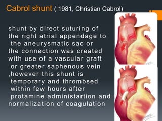 Aortic root surgery. Bentall operation | PPT