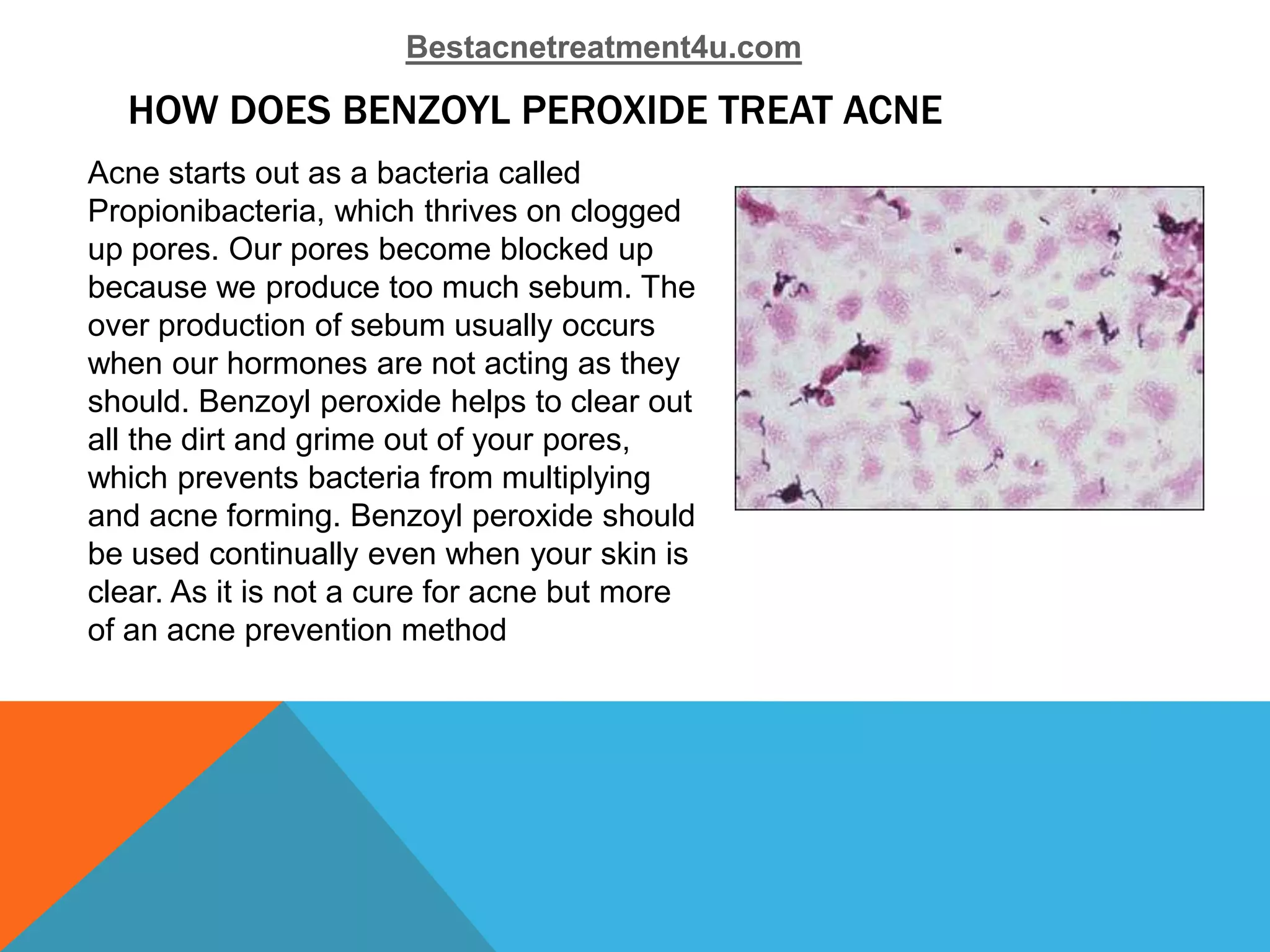 Benzoyl peroxide & acne | PDF